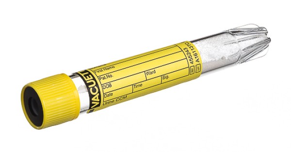 VACUETTE® TUBE 9 ml Urine CCM 16x100 yellow cap-black ring, Conical ...